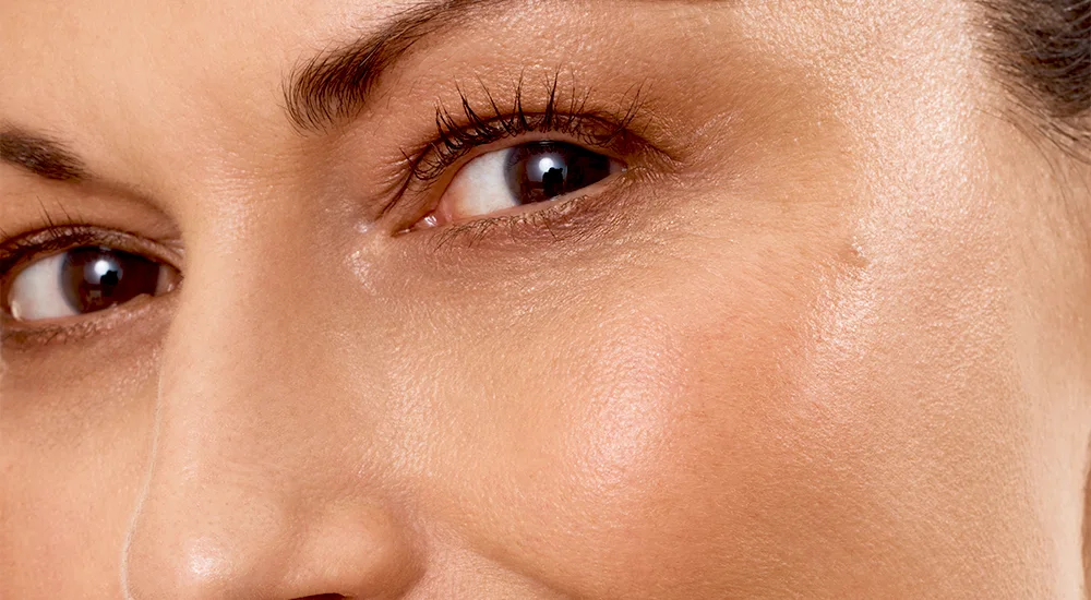 Acne Scar Treatments: Discover the Most Effective Solutions Today ...